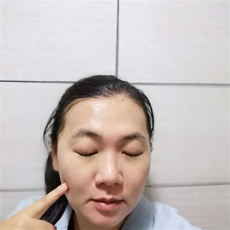 新氧试用官娇兰玻尿酸