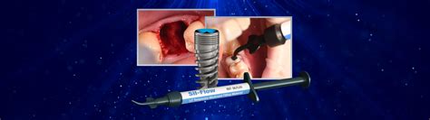 Socket Seal Abutment At Jessica Bullard Blog