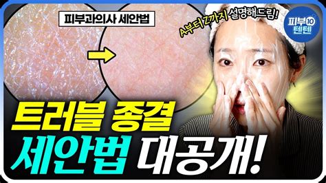 광고 피부 좋은 사람은 꼭 하는 세안법 이것만 바꾸면 피부과 안 와도 됩니다 올바른 세안법 싹 공개 선크림추천 선크림세안법 Youtube