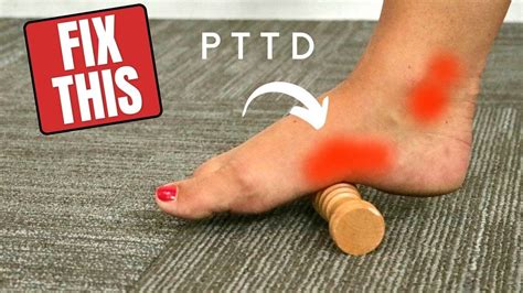Best Eccentric Exercise For Tibialis Posterior Tendon Dysfunction Pttd Youtube