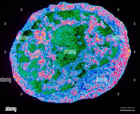 Coloured Transmission Electron Micrograph Tem Showing A Lactococcus Lactis Bacterium It