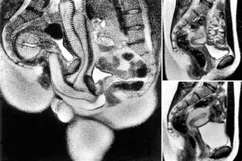 ‘wild Mri Scan Shows What Happens To Our Bodies During Sex Seemayo