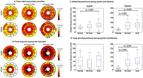 Mr Tissue Phase Mapping Reveals Reduced Left Ventricular Velocities In