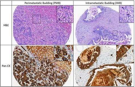Simulating The Human Colorectal Cancer Microenvironment In 48 Off