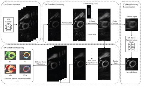 Exploring The Potential Of Deep Learning In Cardiac Diffusion Tensor Imaging Reconstruction