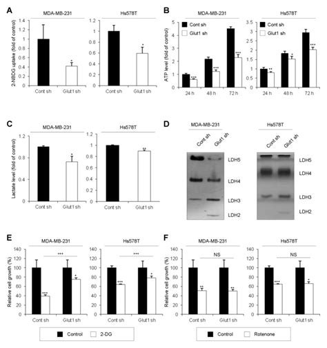 Glut1 Promotes Cell Proliferation Migration And Invasion By Regulating Epidermal Growth Factor