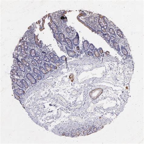 Tissue Expression Of Ret Staining In Duodenum The Human Protein Atlas