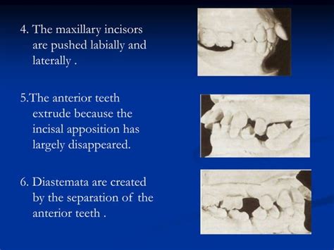 9tooth Mobilityppt Dental Health Diseases And Conditions