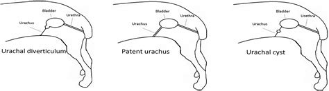 Urachus