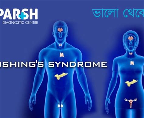 Hypocalcemia Sparsh Diagnostic Center