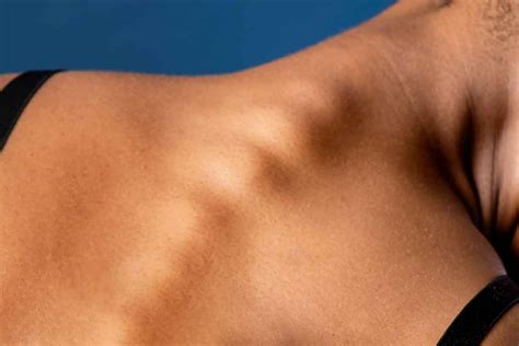 Understanding Vertebral Subluxation And The Benefits Of Upper Cervical Chiropractic Care Upper