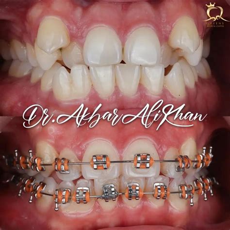 Dr Akbar Khan On Linkedin Dr Akbar Ali Khan On Instagram From I Do Not Want People To Seey