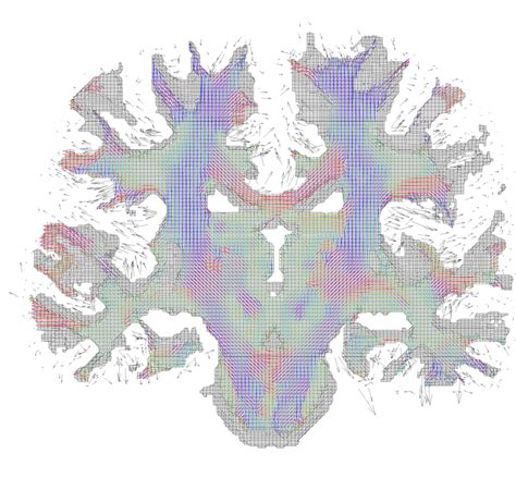 25 EEG Result Dipole Displacements Visualized As Vectors Showing The Download Scientific