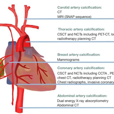 The Anatomical Locations Of The 5 Types Of Vascular Calcification As Download Scientific