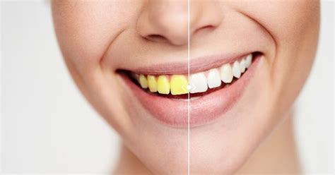 Free Wp Before After Reveal Comparison Plugins Code Canel