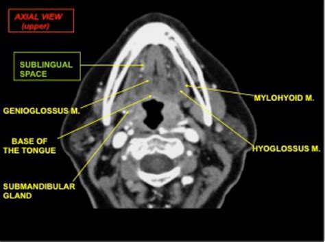 Oral Ct Anatomy At Wendy Noland Blog
