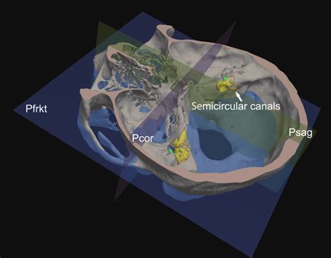 Standard 3 Dimensional Coordinate System Relative To Cranial Base We