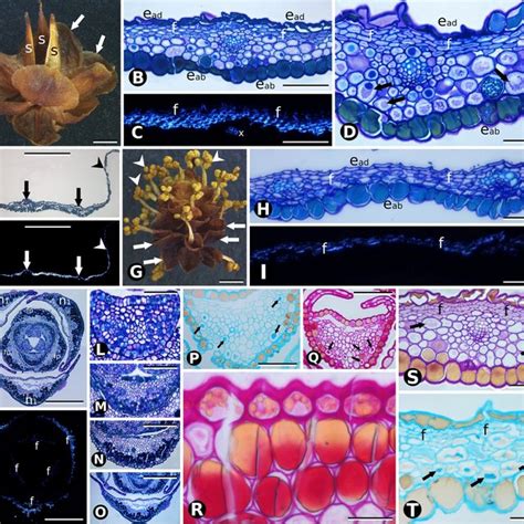 Comparative Morphology And Bract Anatomy Of Ephedra Tweediana Seed