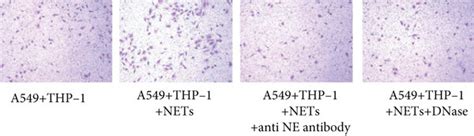 The Contribution Of Nets In Promoting A549 Lung Cancer Cell Migration