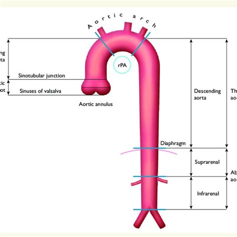 Pdf 2014 Esc Guidelines On The Diagnosis And Treatment Of Aortic