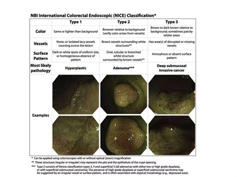 Emr Endoscopic Mucosal Resection Ppt