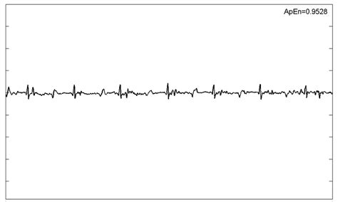 Entropy Analysis Of Different Behaviours Of Af Electrograms A Well Download Scientific