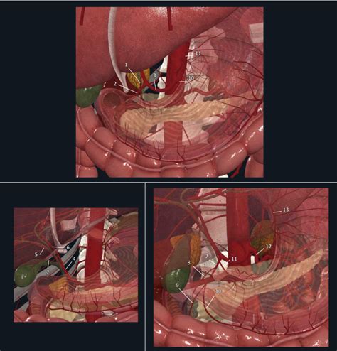 Anatomy Exam 3 Arteries Day 2 Diagram Quizlet