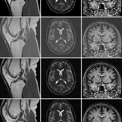 Comparison Of Our Algorithm For Different Choices Of Download
