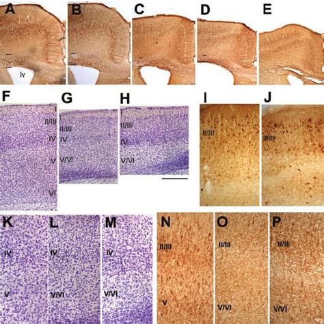 Cytoarchitecture And Cellular Phenotypes Of The Temporal Cortex At Download Scientific Diagram