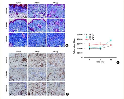 Fibrosis Analysis And Collagen Quantification Fibrosis And Collagen