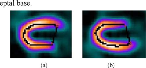 Figure 2 From Development And Validation Of A New Sampling Method To