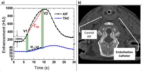 Two Volume Ct Perfusion Measurement Protocol A Top Curve Arterial Download Scientific