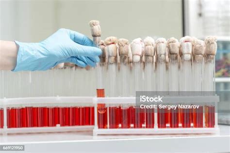 손 들고 혈액 튜브 테스트 및 배경 혈액 튜브 랙 실험실 기술자의 다른 환자 샘플 간호사에 대한 스톡 사진 및 기타 이미지 간호사 색상 견본 수집 Istock