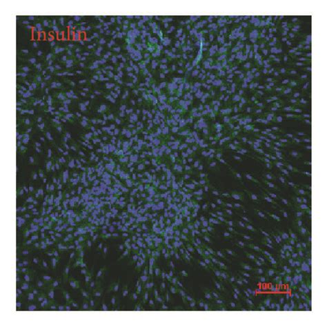 Immunofluorescence Staining Of Insulin In Rat Adscs Induced Into