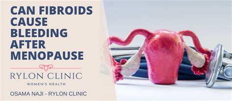 Can Fibroids Cause Bleeding After Menopause