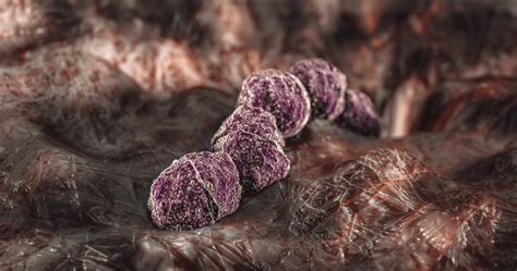 Beta Hemolytic Streptococcus Over 4 Royalty Free Licensable Stock Illustrations And Drawings