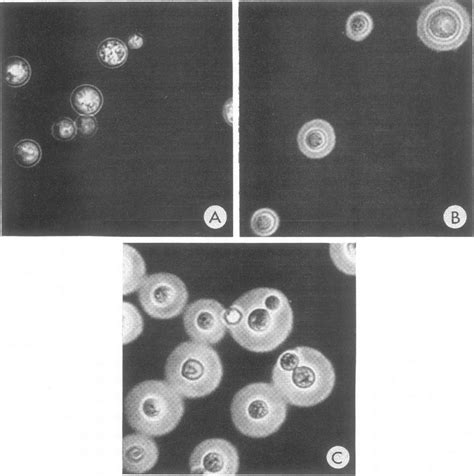 Figure From Cryptococcus Neoformans Semantic Scholar