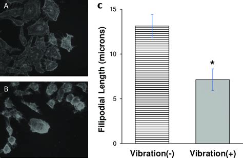 Vibration Alters Actin Filament Organization Representative