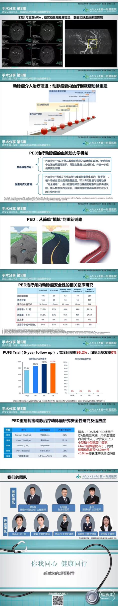 谢万福教授团队手术分享第5期：密网支架 Pipeline Flex 治疗复发血泡样动脉瘤1例 脑医汇