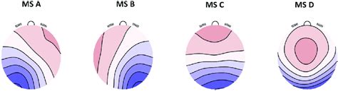 Microstate Normative Maps MS A Microstate A MS B Microstate B Download Scientific Diagram