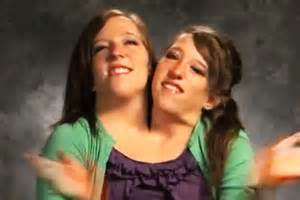 Conjoined Twins Abby And Brittany Hensel Spotted Out After Wedding News Photos