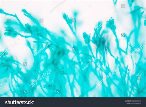 Penicillium Slide