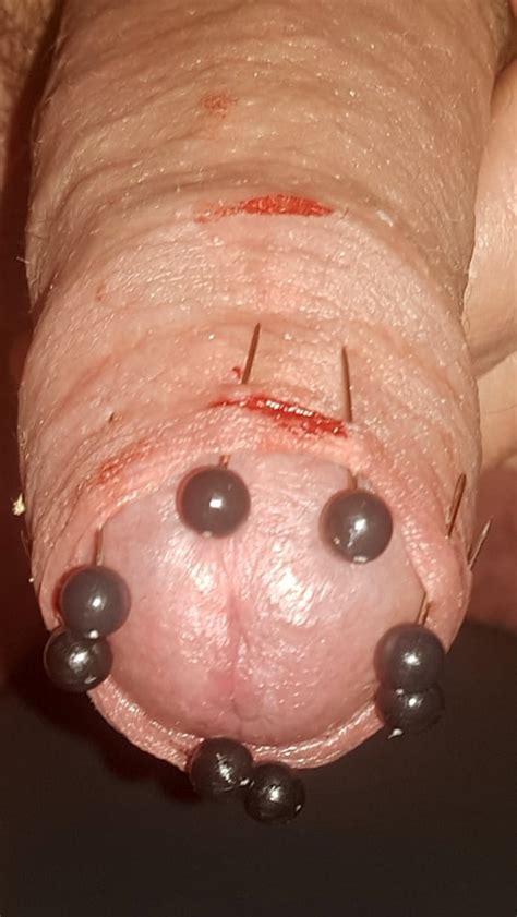 Cbt Needles 2 20 Pics Xhamster