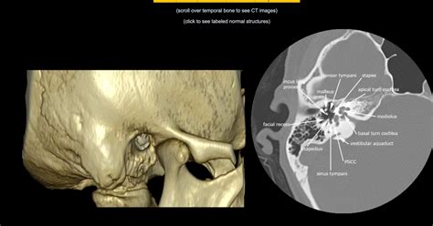 How To Annotatemarkup An Image With Arrows And Anatomical Names