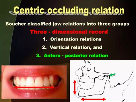 Clinical Steps For Complete Denture Construction 4 Steps Of Recording