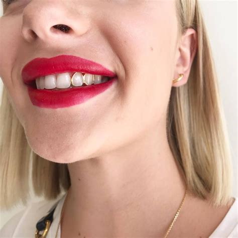Grills Teeth Nz At Peggy Hodges Blog