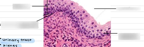 Transitional Epithelium Diagram Quizlet