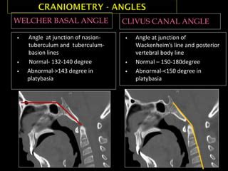 Cvj Lines And Angles Pdf