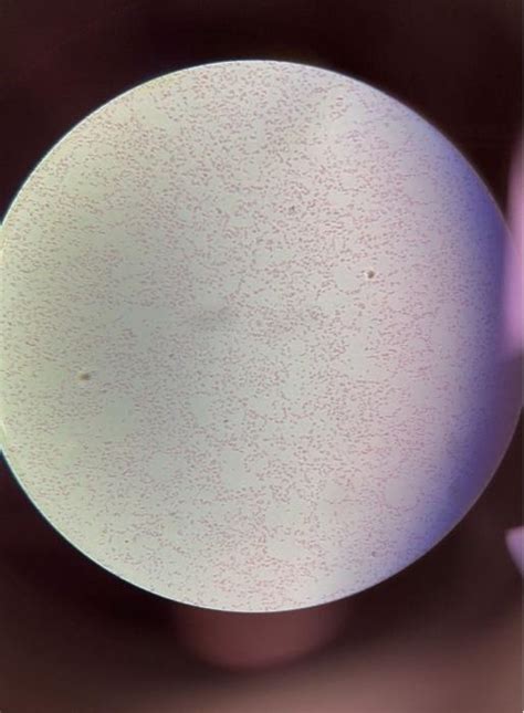 Solved Is This A Positive Endospore Or A Negative Endospore