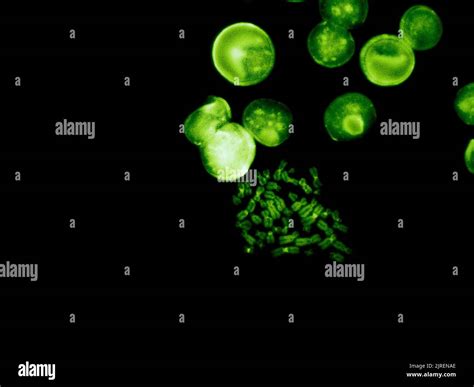 Chromosomes Under Fluorescence Microscope Green Colored Human
